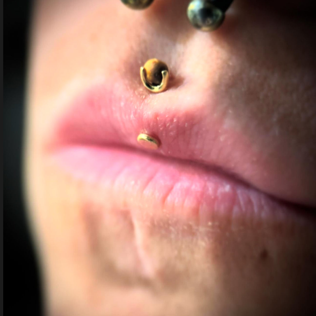 Vertical Philtrum (Jestrum) Piercing – Tine Piercing