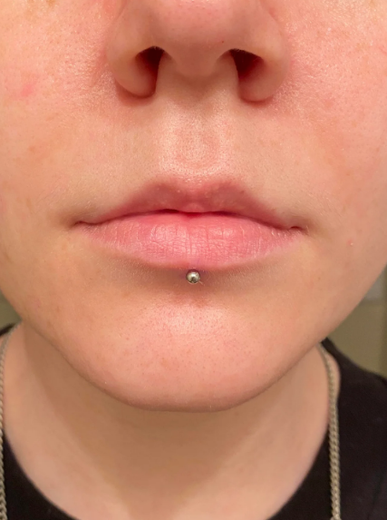 Labret (Lip) Piercing – Tine Piercing
